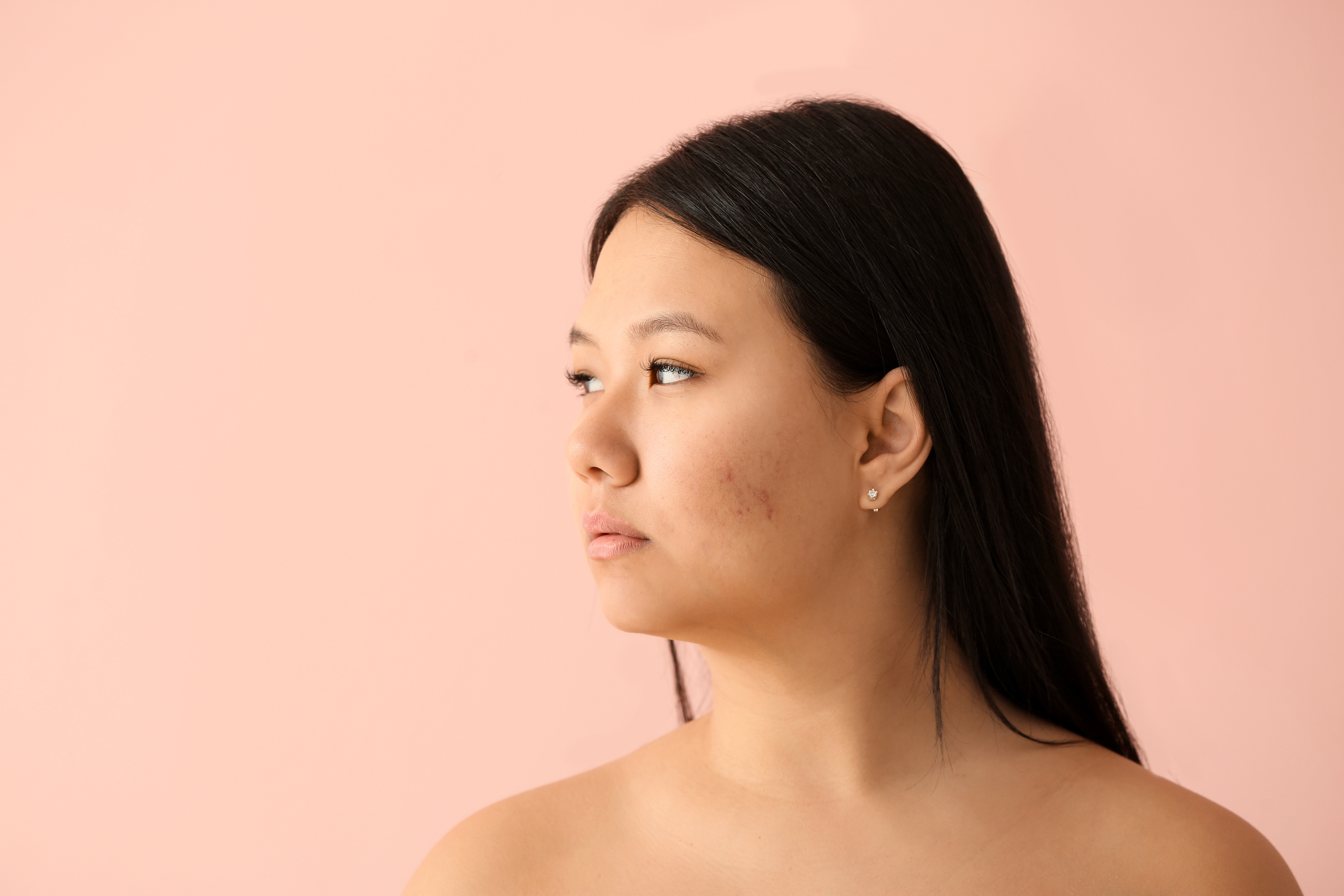 Face Mapping: An Ancient Guide to Reading Your Breakouts